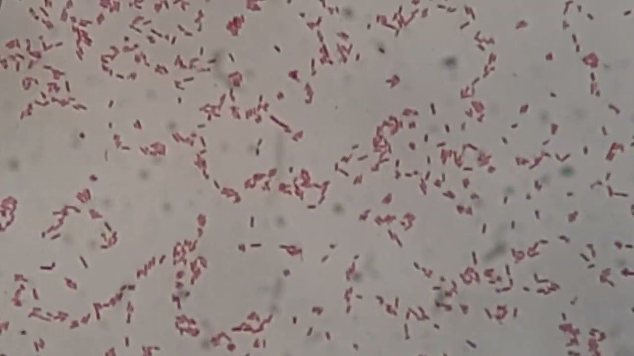 Is Citrobacter Freundii Gram Positive Or Negative
