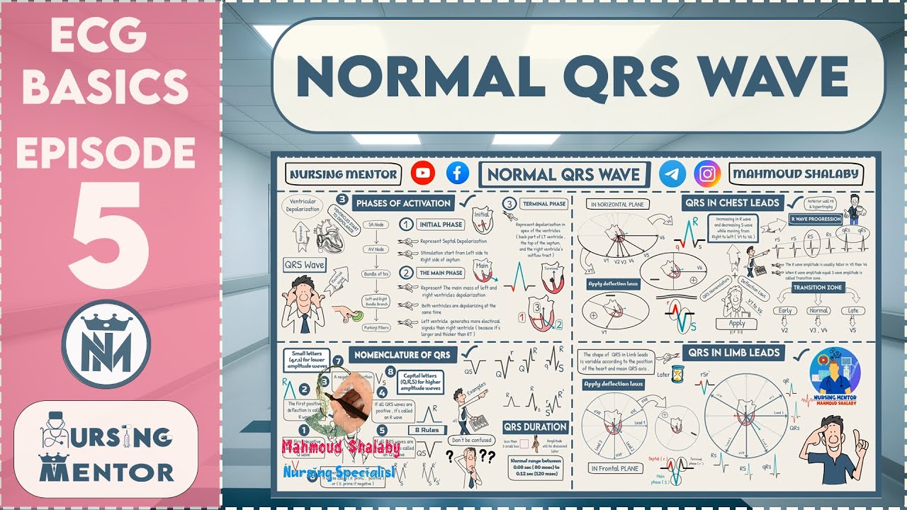 Normal QRS wave ( Nomenclature of QRS wave , R wave progression , QRS ...