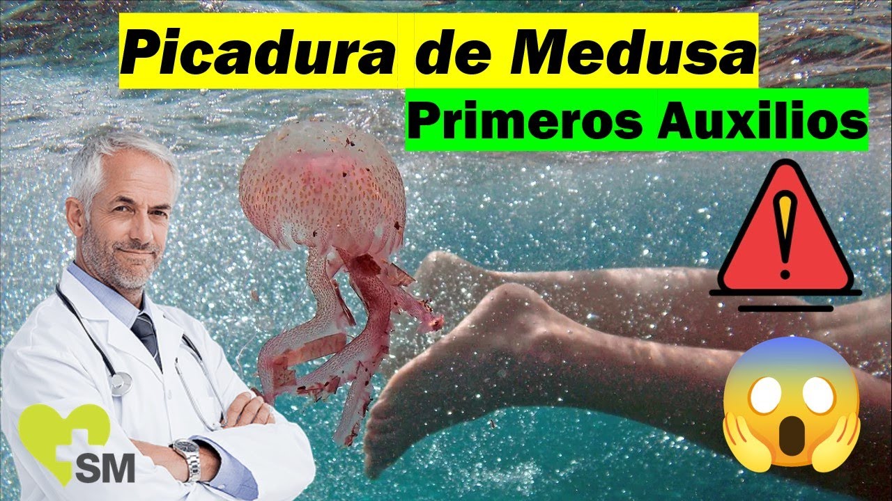 La Picadura de medusa 🦑🌊 | 🚨 Tratamiento, Primeros auxilios - YouTube