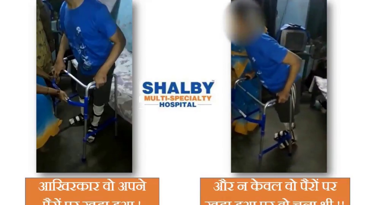 distal extension femoral osteotomy for cerebral palsy - YouTube