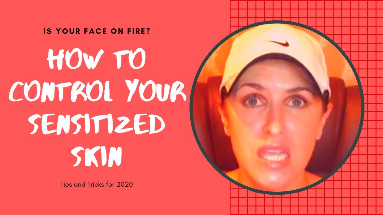 The WORST things to do for Sensitized Skin Condition - YouTube