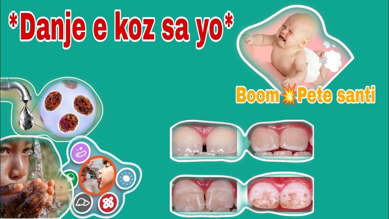 15 move maladi Bwè Move Dlo bay - 5 rezon Pete Santi Tibebe- 6 koz Dan Kado - YouTube