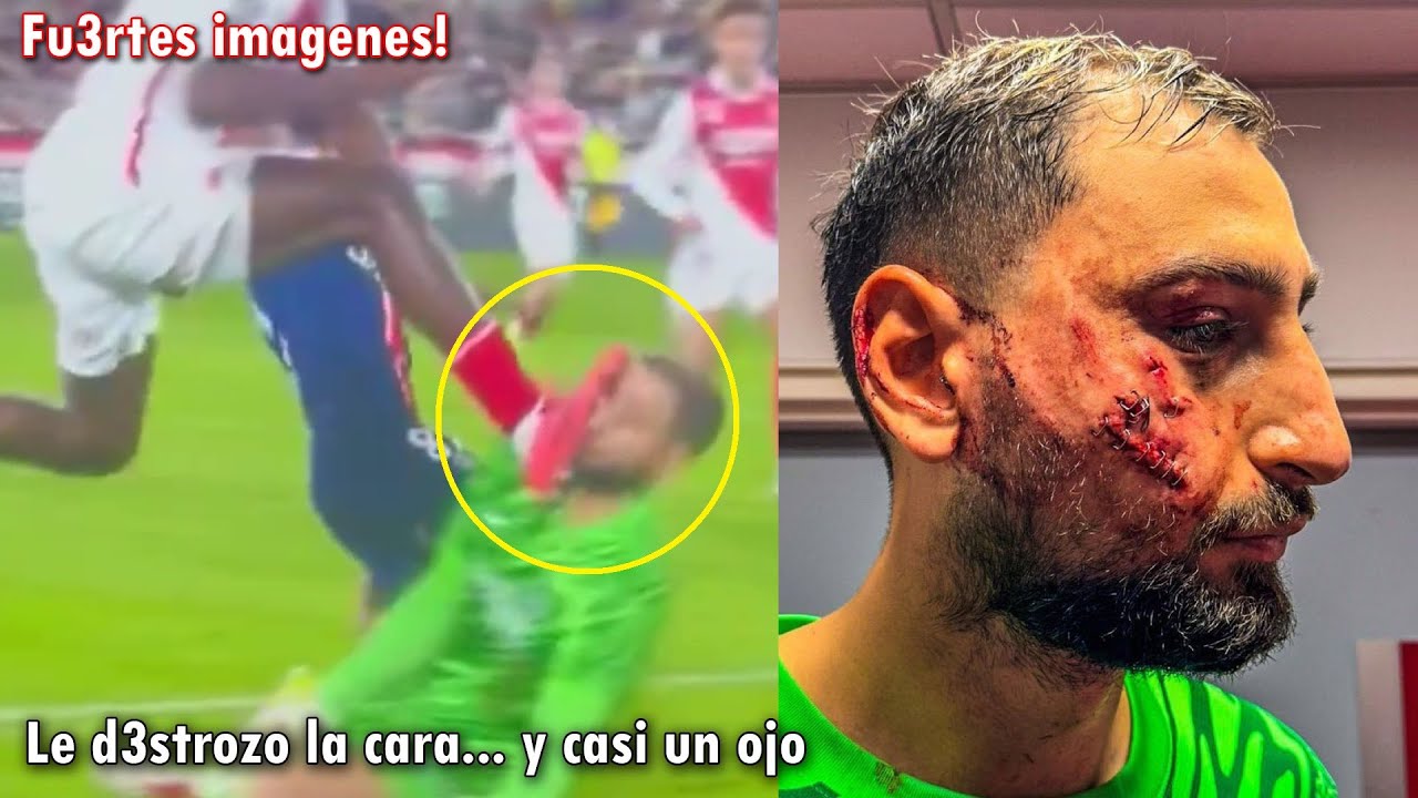 ASI FUE LA TERRIBLE LESION en la CARA a DONNARUMMA HOY - YouTube
