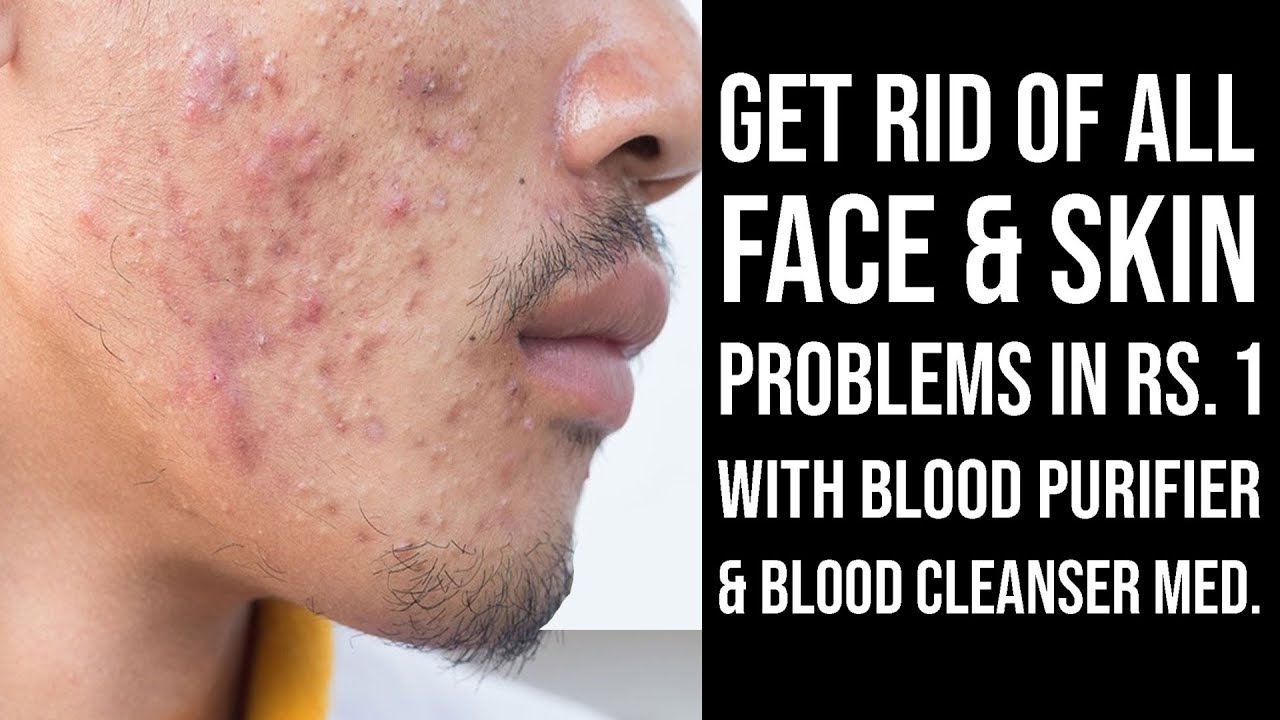 One Tablet To Get Rid Of Black Skin Acne Scars Dark Circles Other one-tablet-to-get-rid-of-black-skin-acne-scars-dark-circles-other