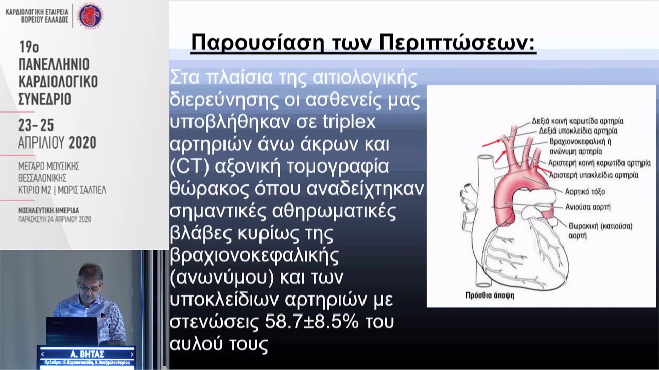 Α. Βήτας | OR 12. ΔΙΑΒΡΑΧΙΟΝΙΟΣ ΔΙΑΦΟΡΑ ΑΡΤΗΡΙΑΚΗΣ ΠΙΕΣΗΣ - ΠΑΡΟΥΣΙΑΣΗ ...