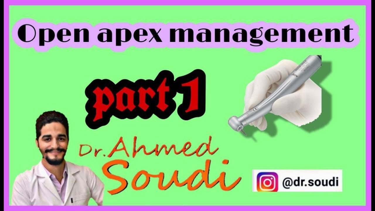 Open Apex (part one) - YouTube