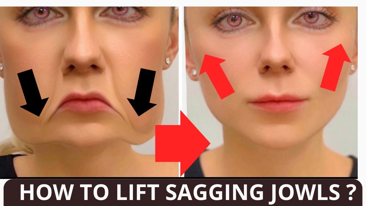 🛑 FACE LIFTING EXERCISES FOR JOWLS & LAUGH LINES ! NASOLABIAL FOLDS ...