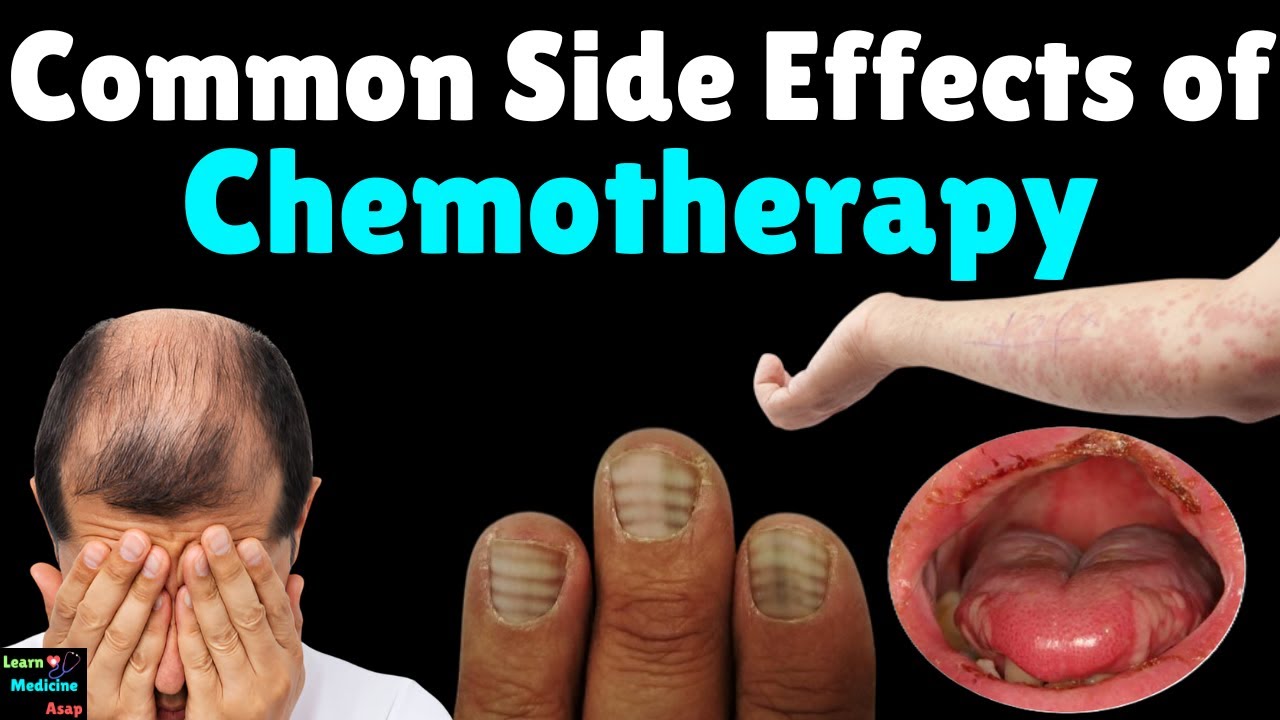Chemotherapy Side Effects | Side Effects of Chemotherapy – Symptoms ...