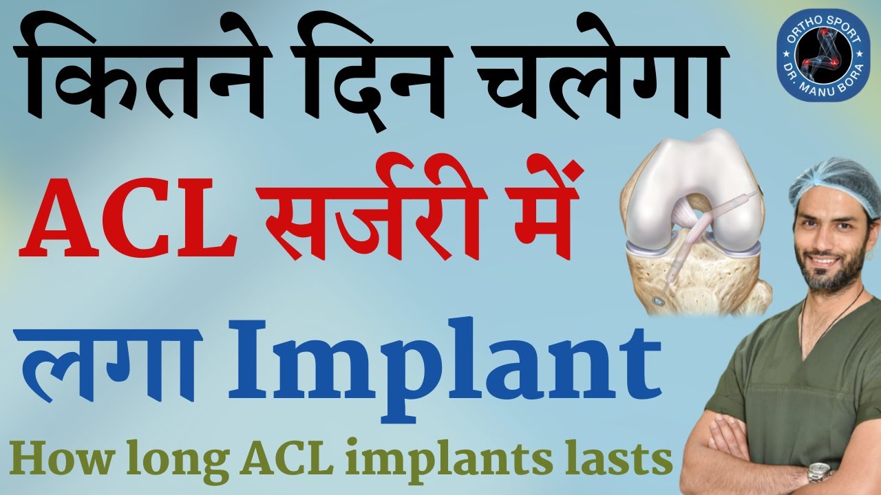 कितने दिन चलेगा ACL इम्प्लांट? How long do ACL Surgery implants lasts ...