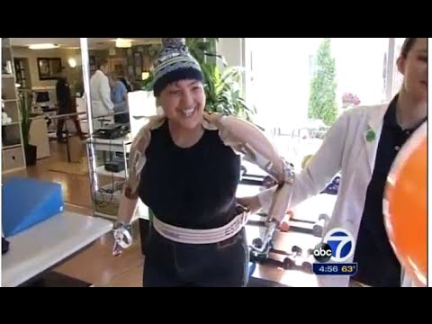DSD Gehane with prosthetic arms - YouTube