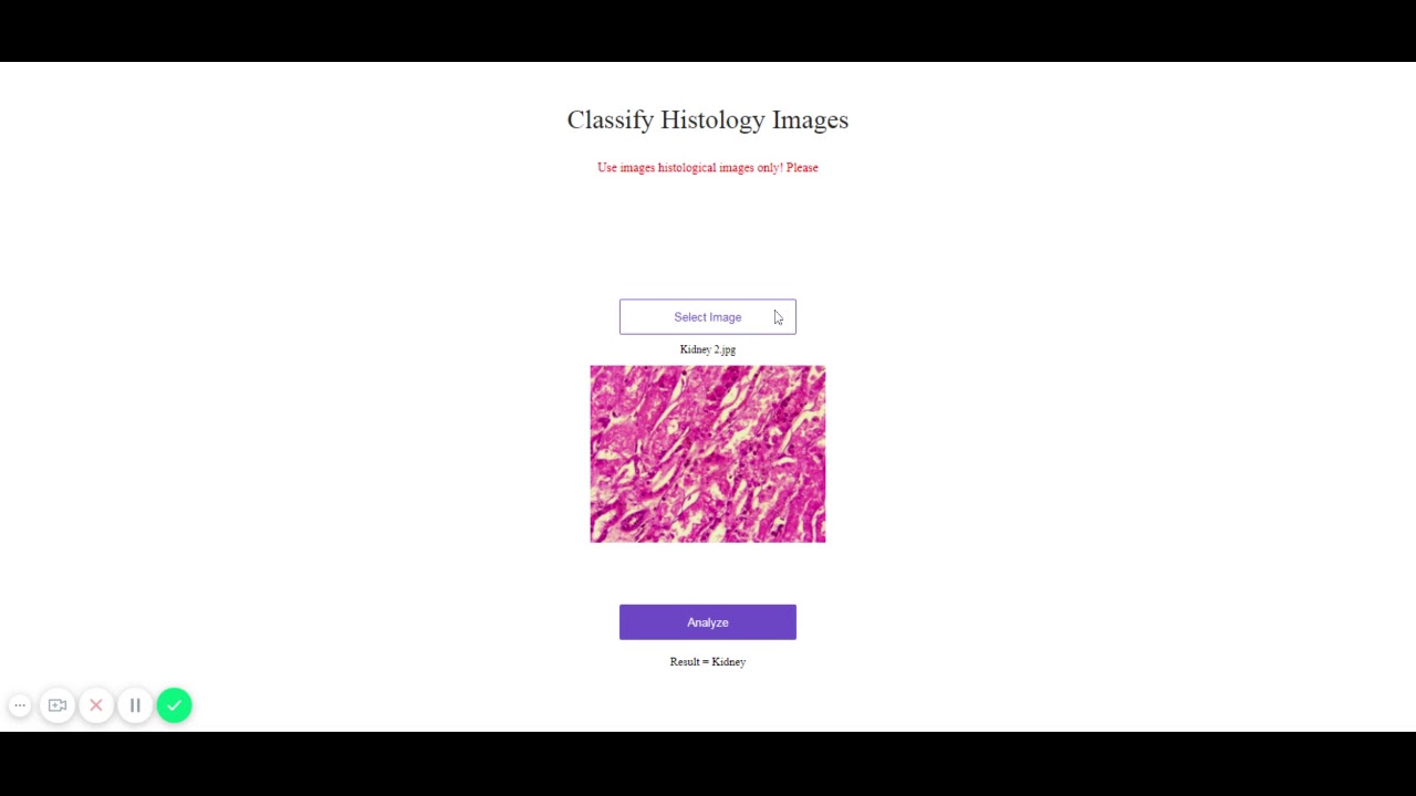Histology Image classification web app - YouTube