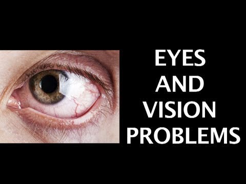 Malabo Mata: Tips at Gamutan - ni Dr Nitz Sarthou (Optometrist) #1 ...