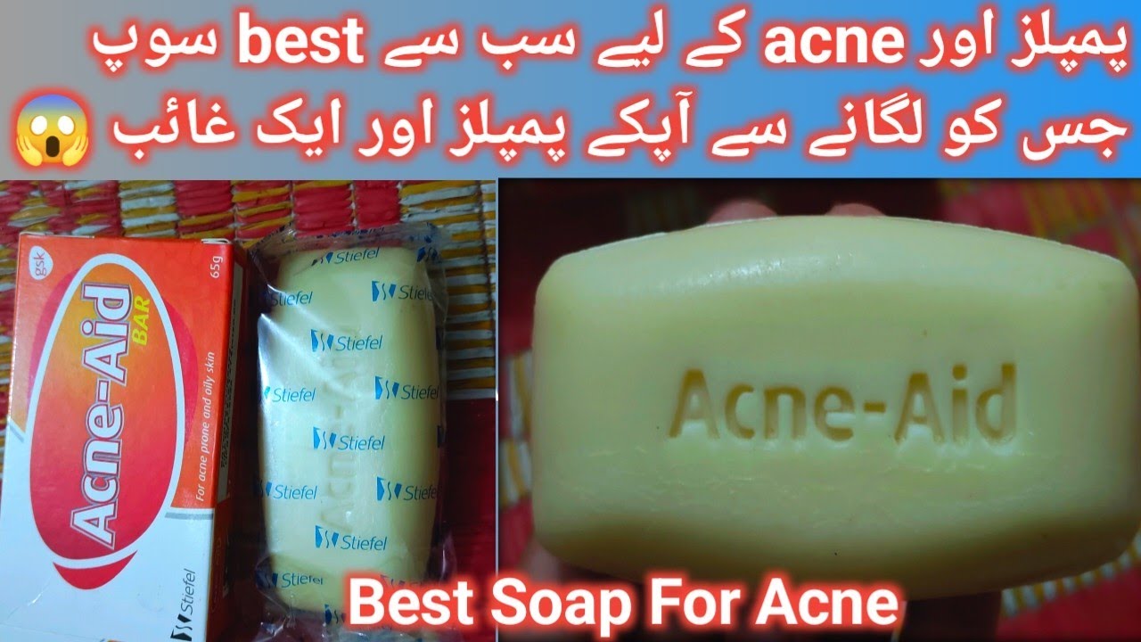 Acne Aid Bar Soap Honest Review | Which is the best soap for acne ...