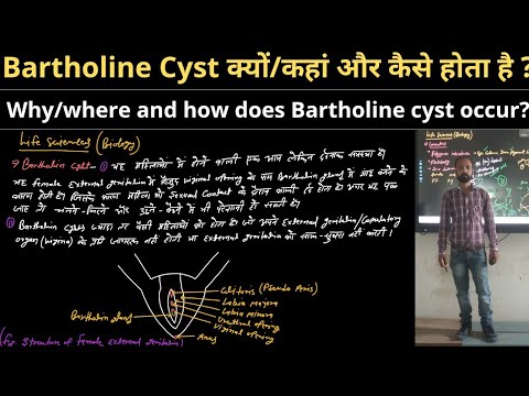 Bartholin Cyst क्यों/कहां और कैसे होता है || Why/Where and How is ...