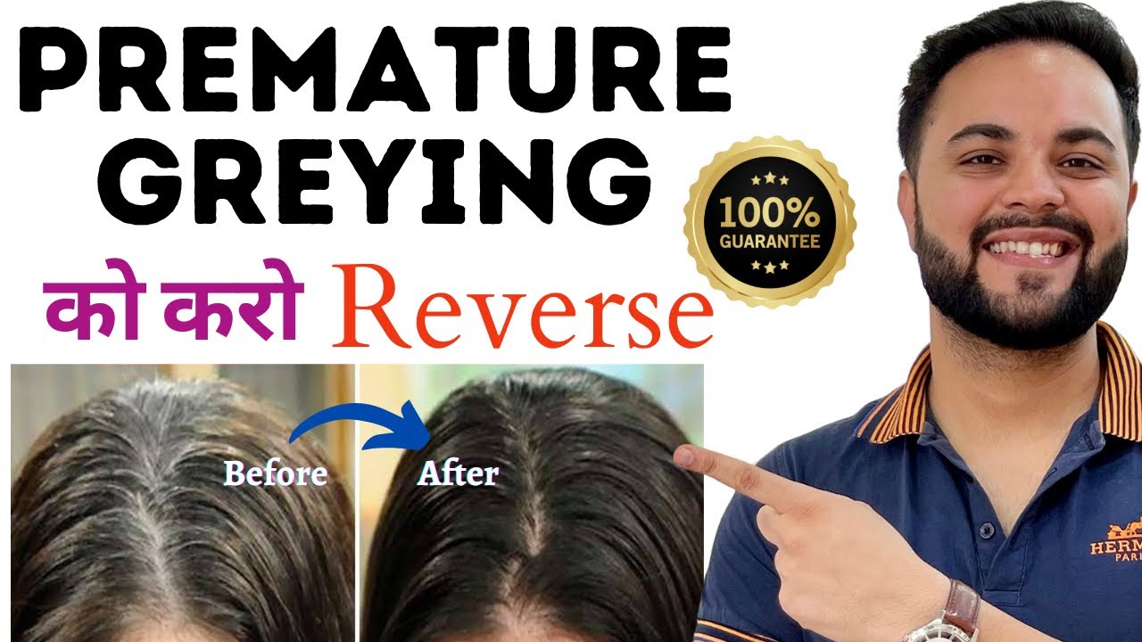 Premature Greying को करो Reverse in 14 Days || 100% Results - YouTube