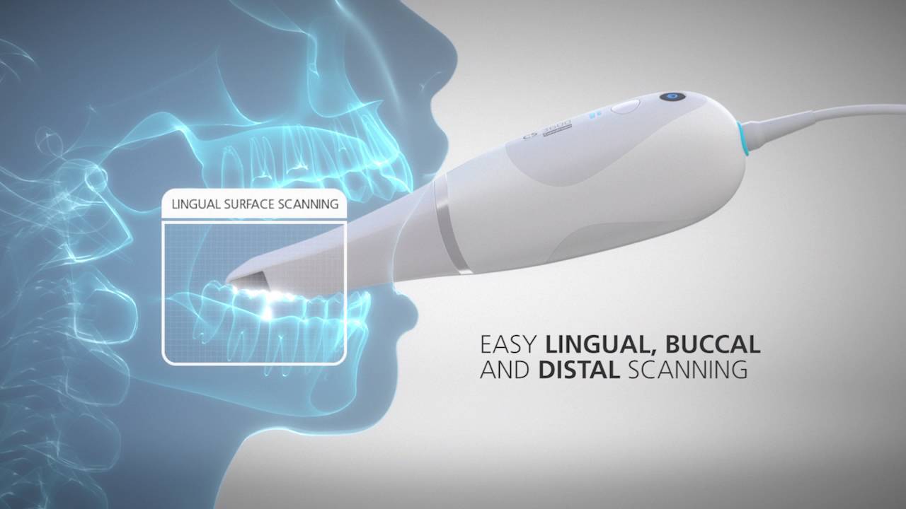Scanner Intraorale Carestream CS3600 - Linea Diretta - YouTube