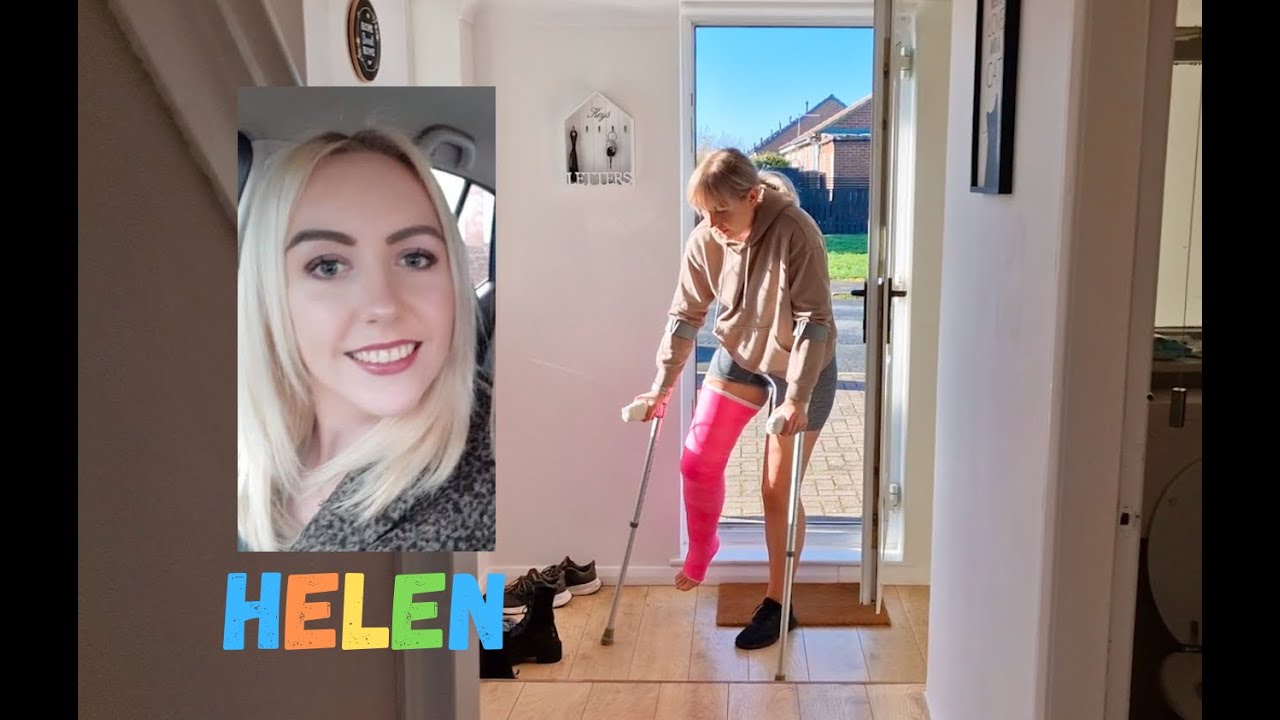 Long Leg Cast - YouTube