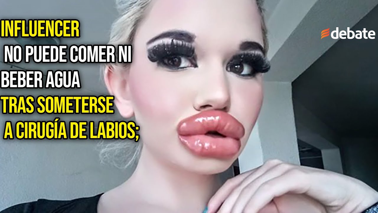 Influencer no puede comer ni beber agua tras someterse a cirugía de ...