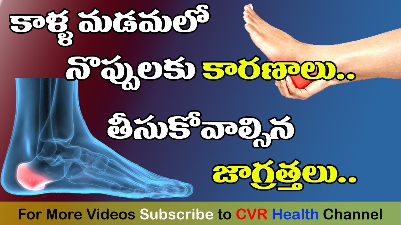 Heel Pain (Plantar Fasciitis): Causes, Treatments, Symptoms ...