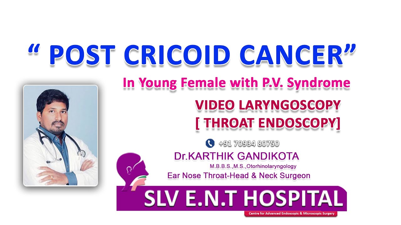 "Post Cricoid Cancer" in female || Dr.Karthik Gandikota || consultant ...