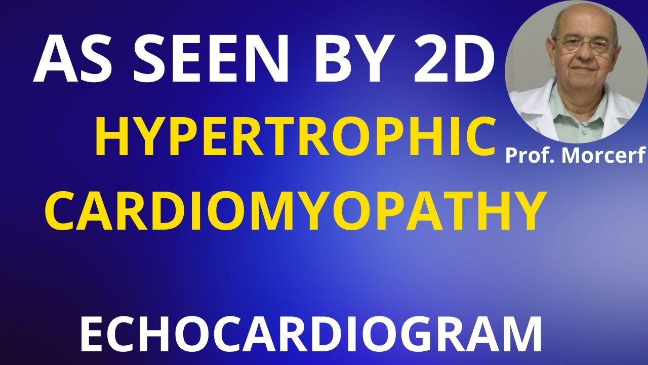 Full Insight into 2D Echo Aspect of Hypertrophic Cardiomyopathy - YouTube