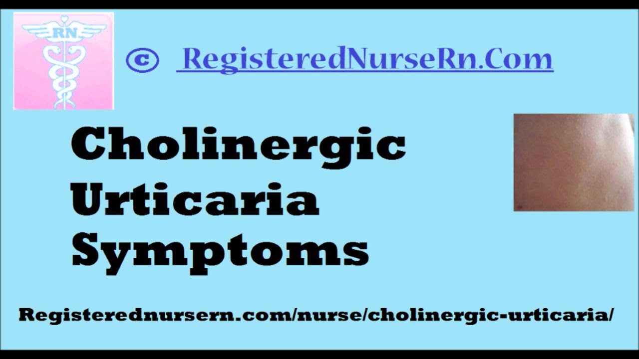 Cholinergic Urticaria Symptoms Treatment And Causes