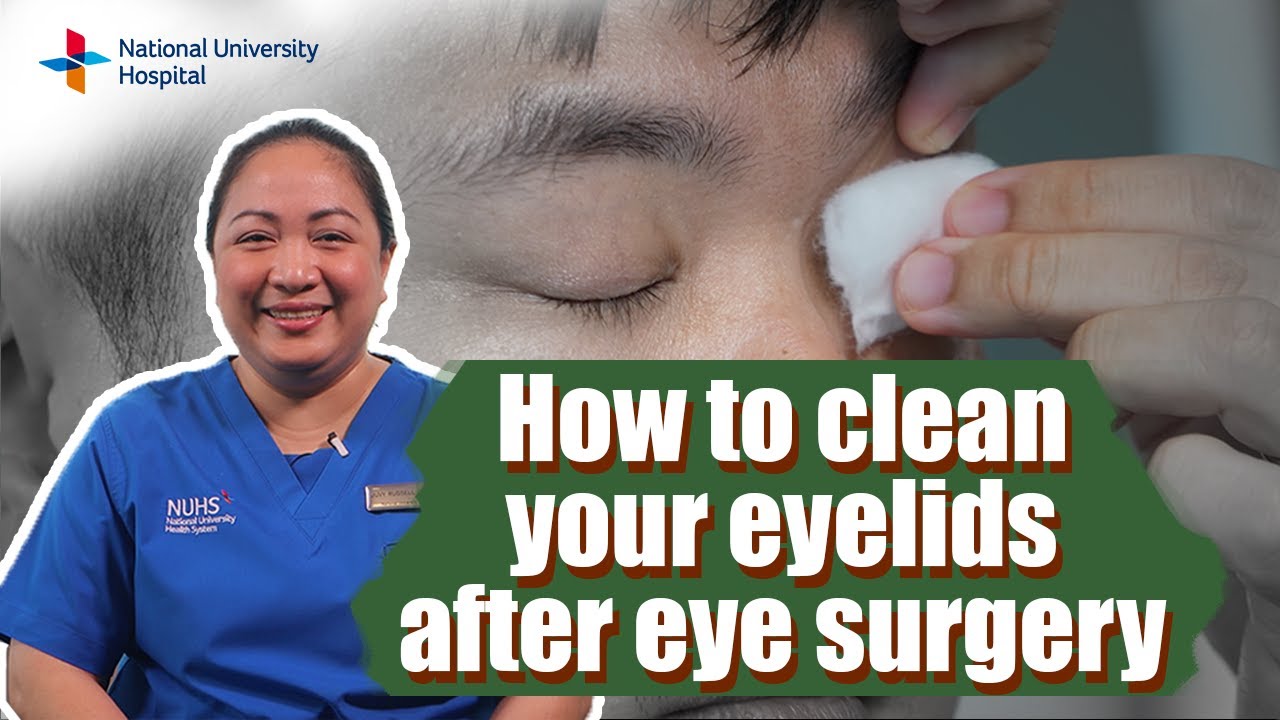 How to clean your eyelids after eye surgery - YouTube