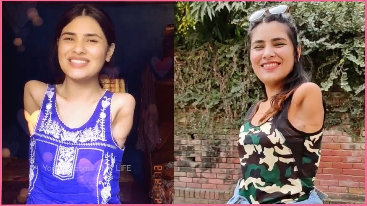 Happiness depends upon ourselves.double shoulder disarticulation ...