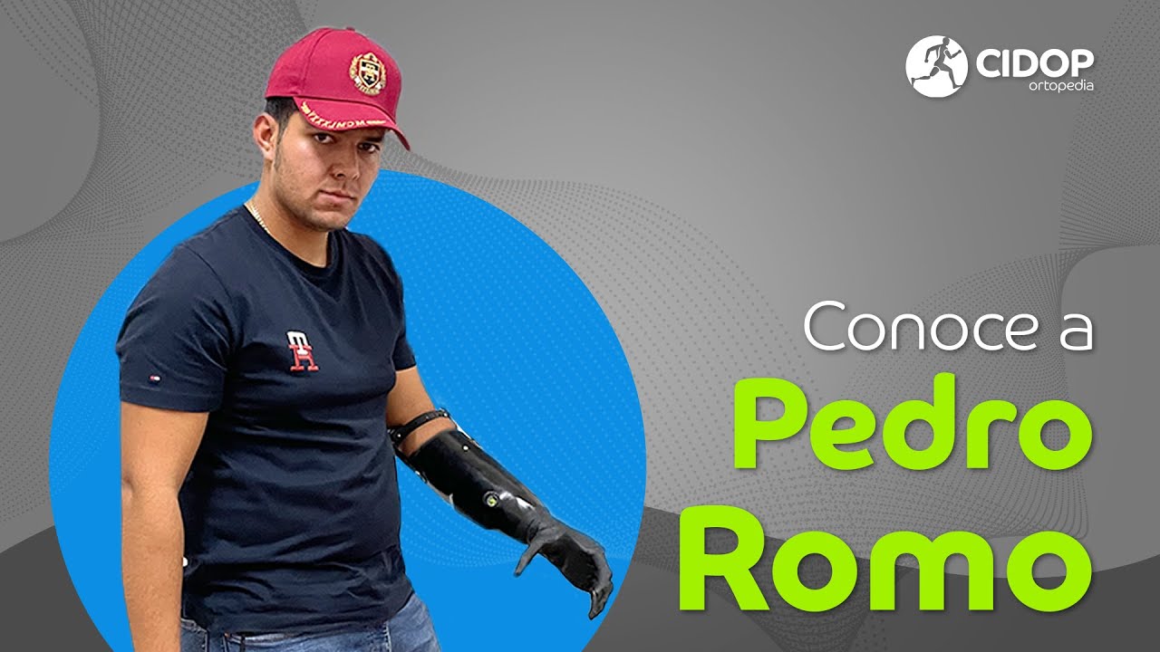 Pedro Romo - Prótesis para amputación de mano - YouTube