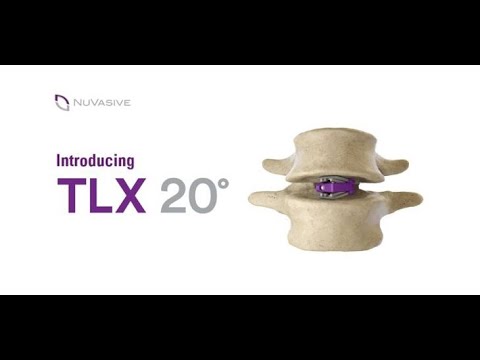 NuVasive: TLX 20 Procedural Animation - YouTube