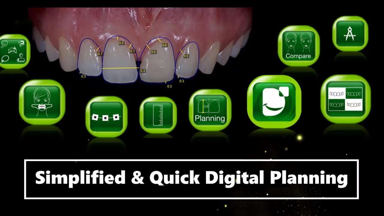 Digital Treatment Planning with DTS PRO - YouTube