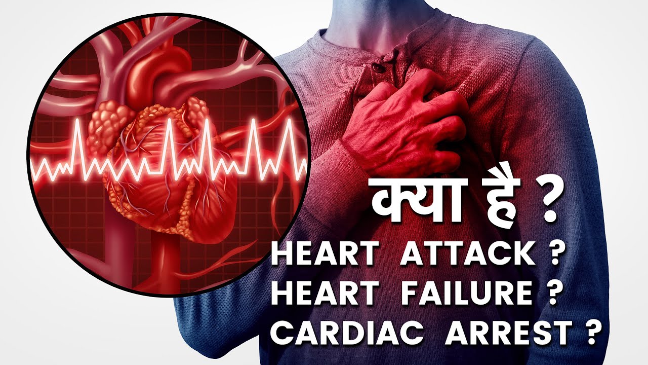 What Is the Difference between Heart Attack, Heart Failuire & Cardiac ...