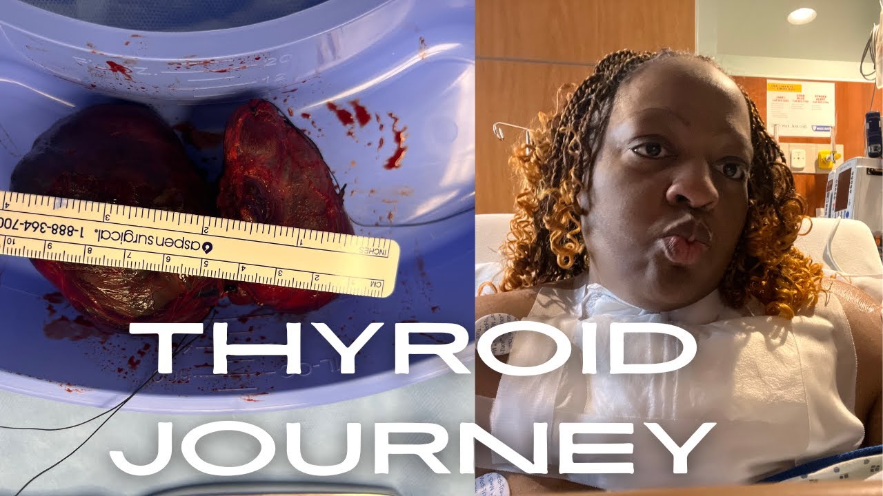 THYROID JOURNEY; TIME FOR MY THYROID REMOVAL SURGERY. COME WITH ME ...