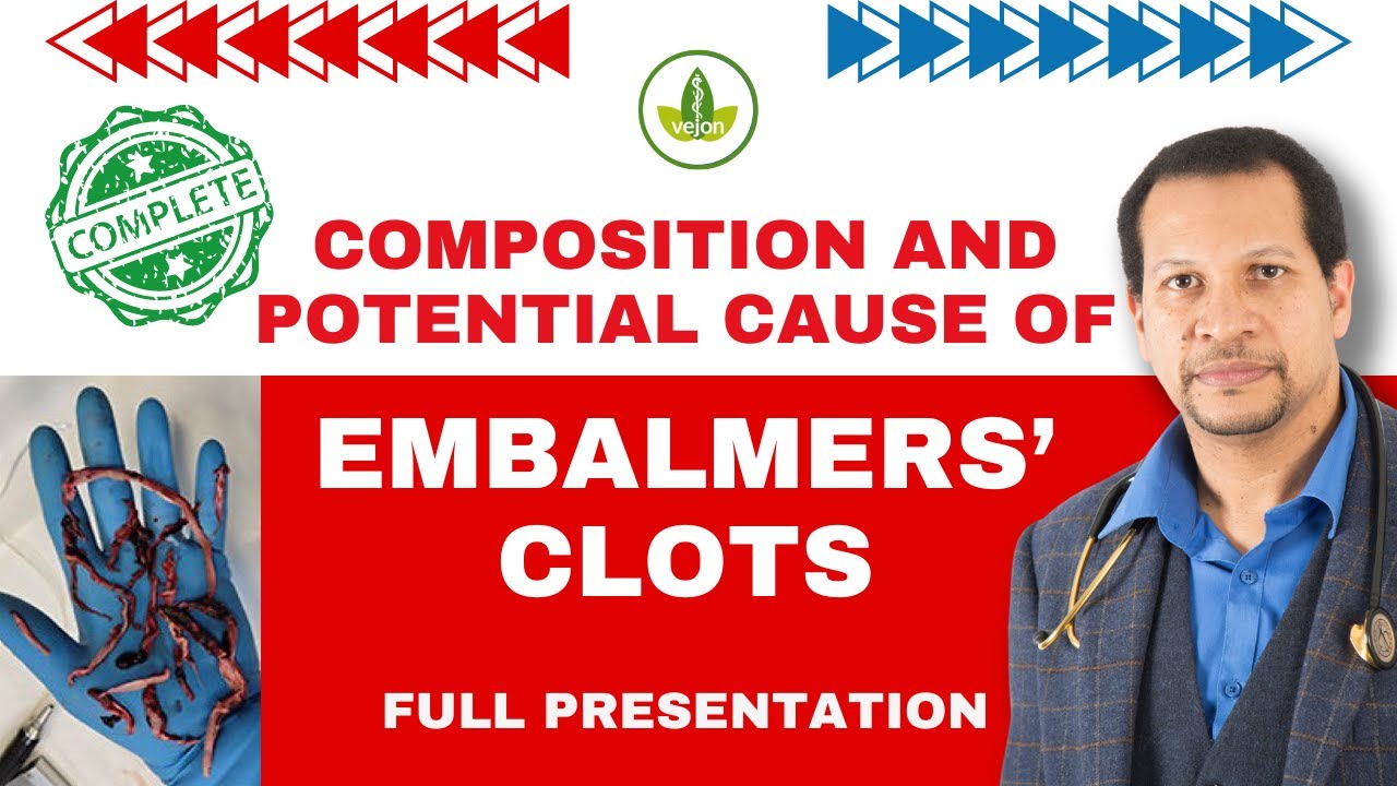 What's REALLY Causing Embalmers Clots and Why You Need to Know - YouTube