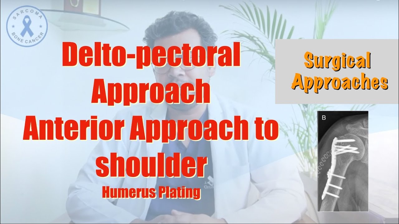 Anterior Approach to Shoulder Joint: Deltopectoral Approach & Humerus ...