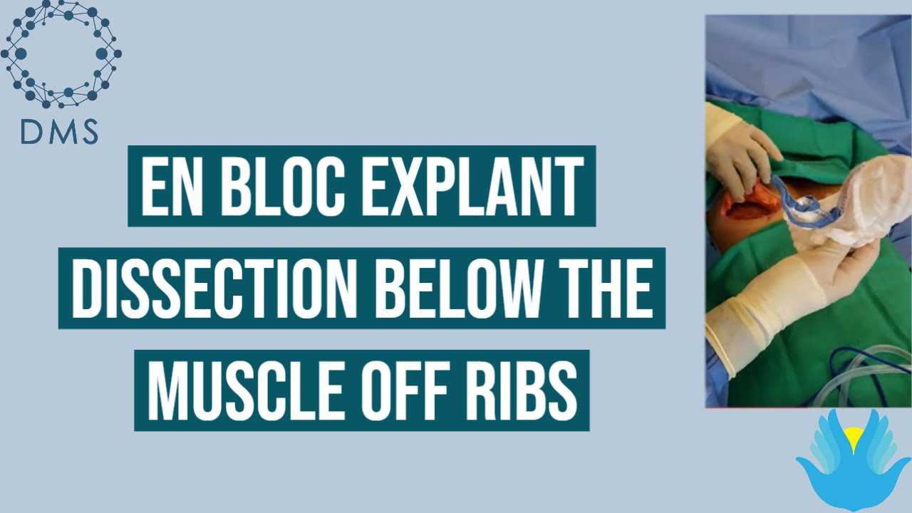 NO DRAINS REQUIRED! - BLOODLESS FIELD - En Bloc Explant Dissection ...