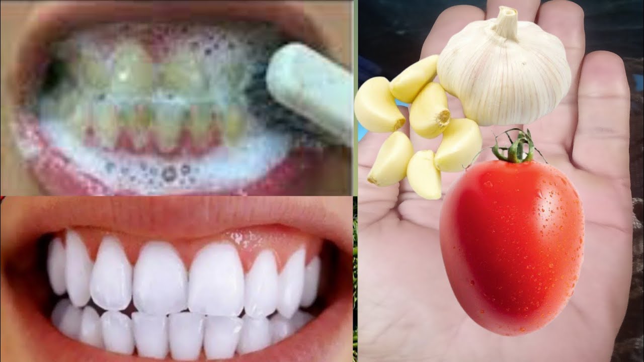 Teeth Whitening At Home / Easy Way To Teeth Whitening / Teeth Whitening ...