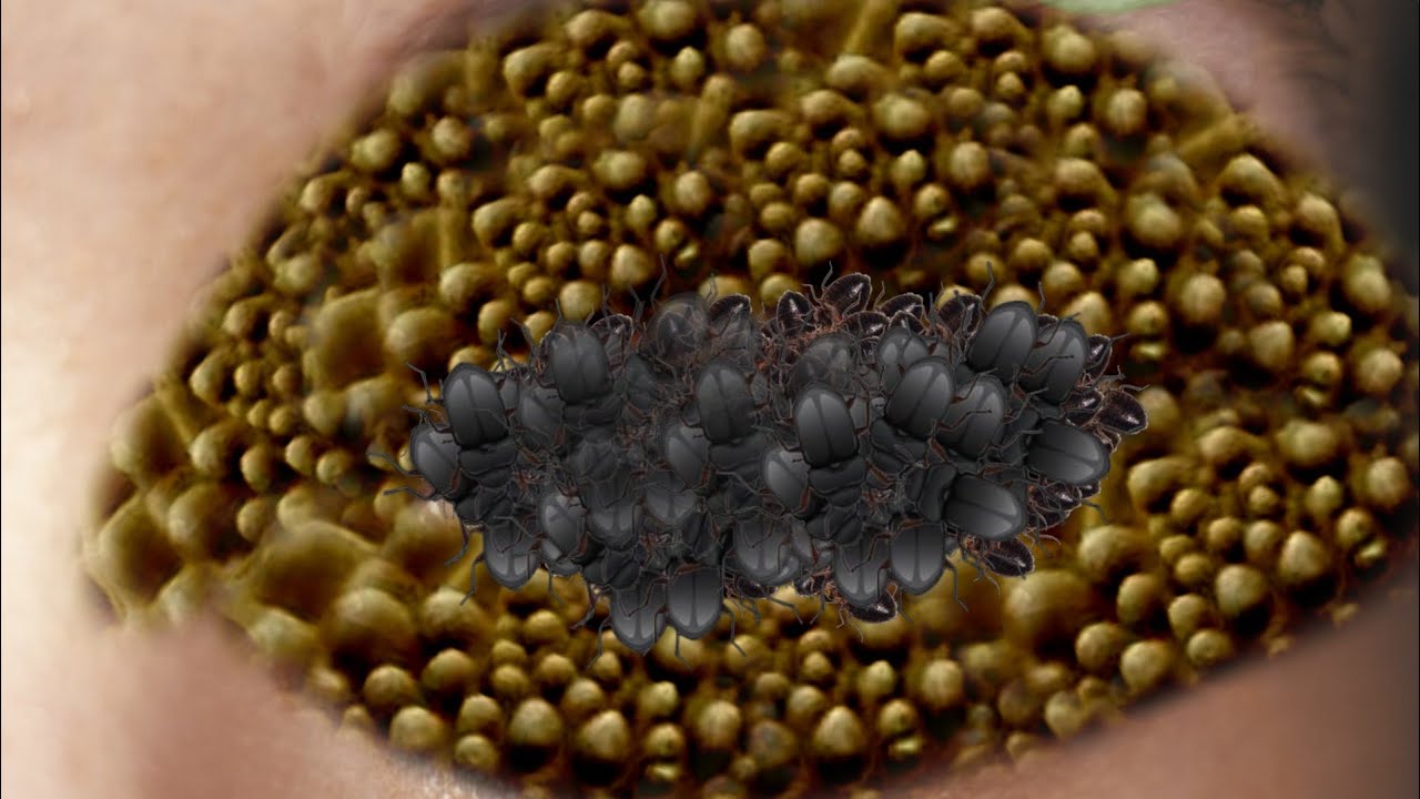 ASMR Eyes Animation Infection Treatment| Asmr injury eyes 👀 and ...