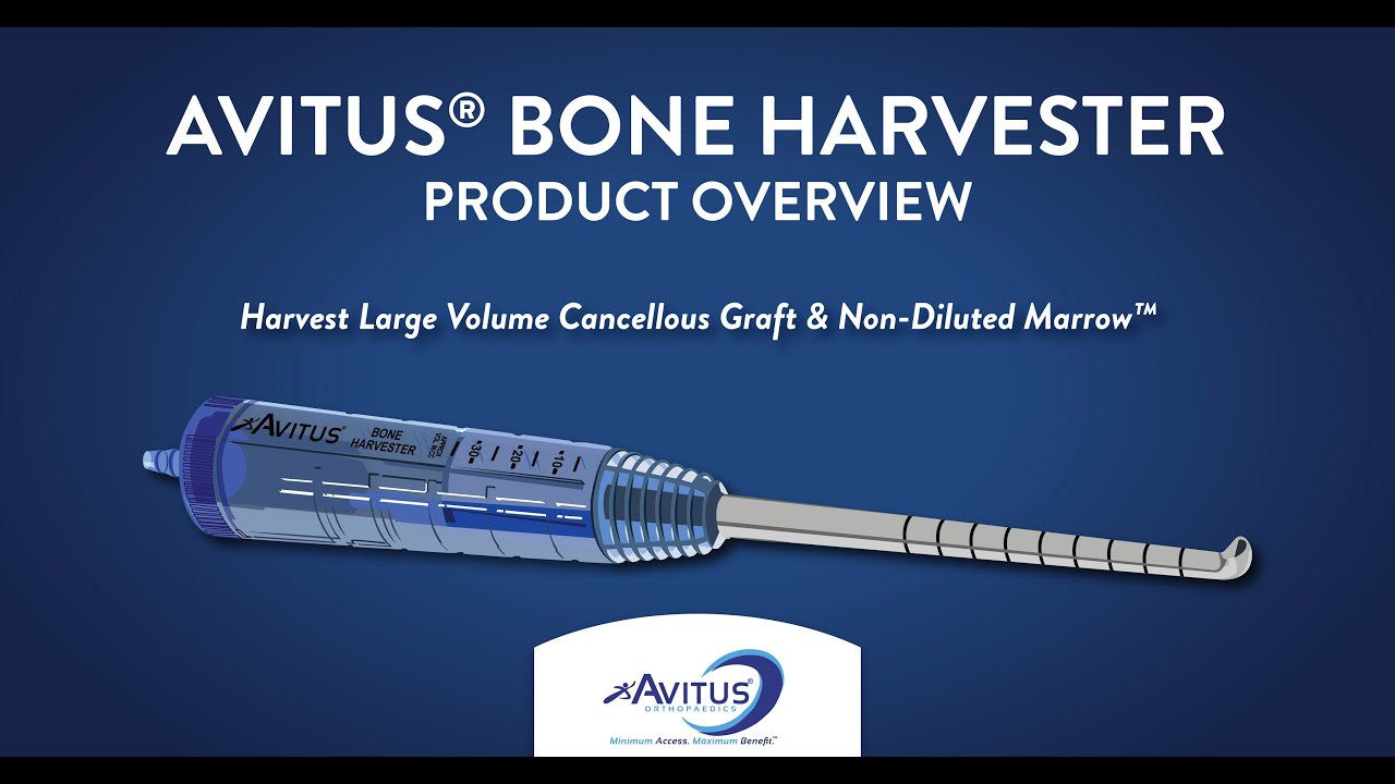 The Avitus® Bone Harvester - Bone and Marrow Harvester - Empower Your Fusions - YouTube