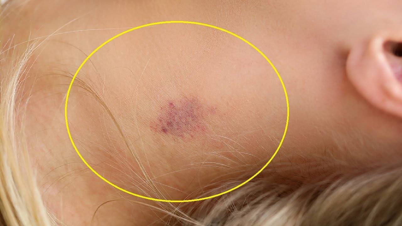 how to get a fake hickey on your neck tutorial - YouTube