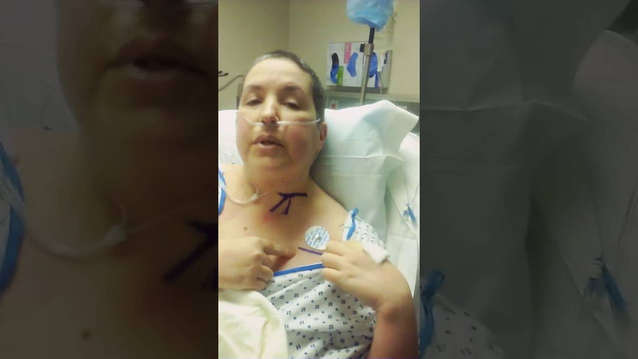 VNS surgery - YouTube