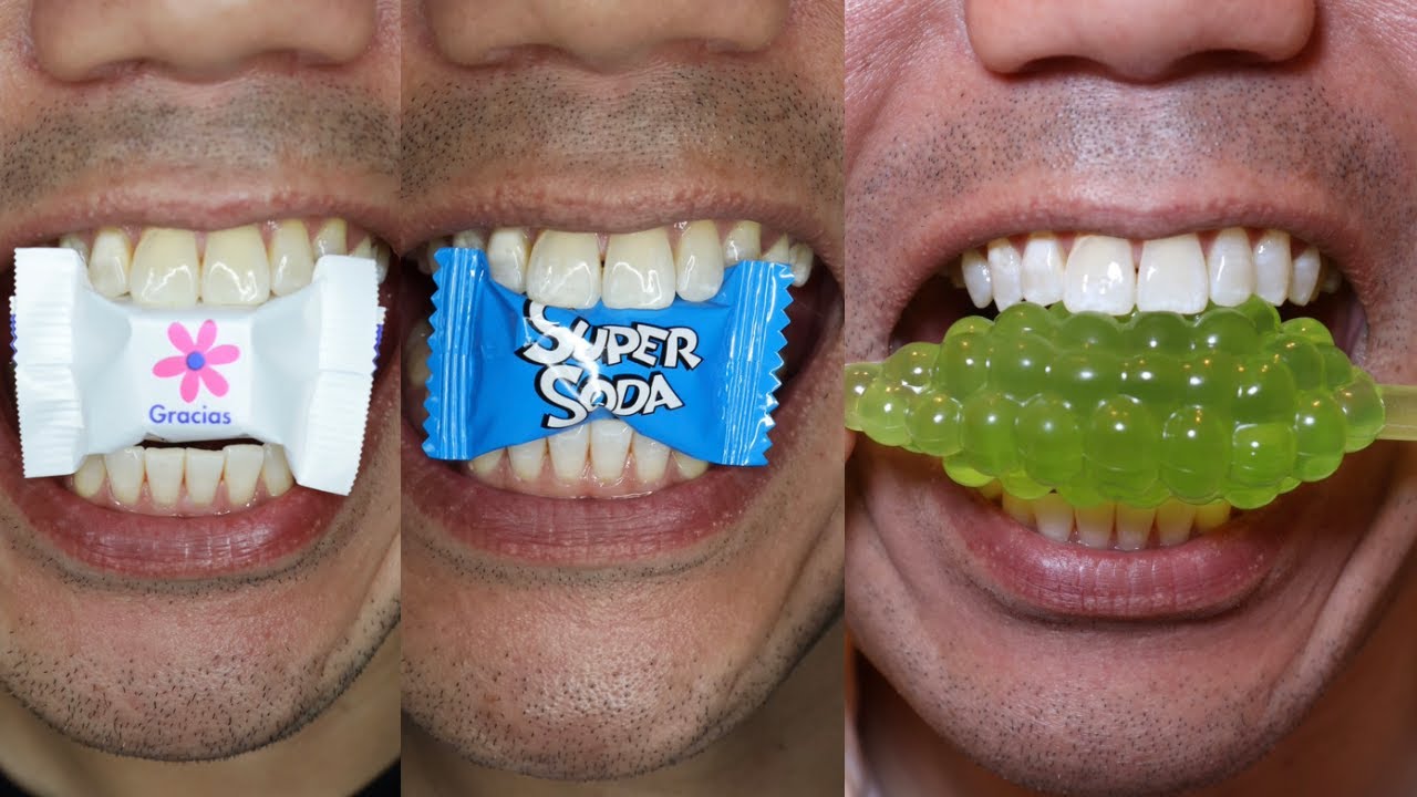 🍭 Best of the Best: Viral Chocolate & Candy ASMR Compilation for Sweet ...