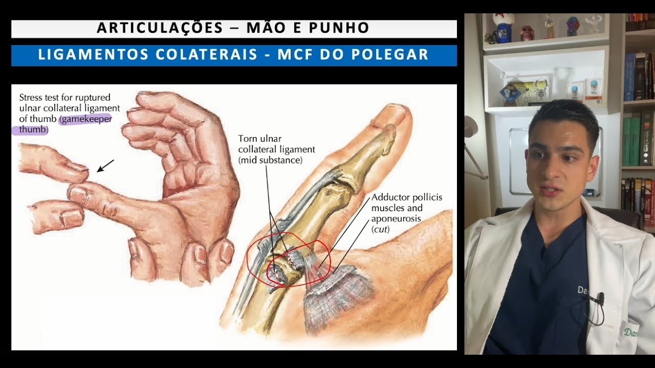 Lesão de Stener #ANATOMIA | Daniel Bohn - YouTube