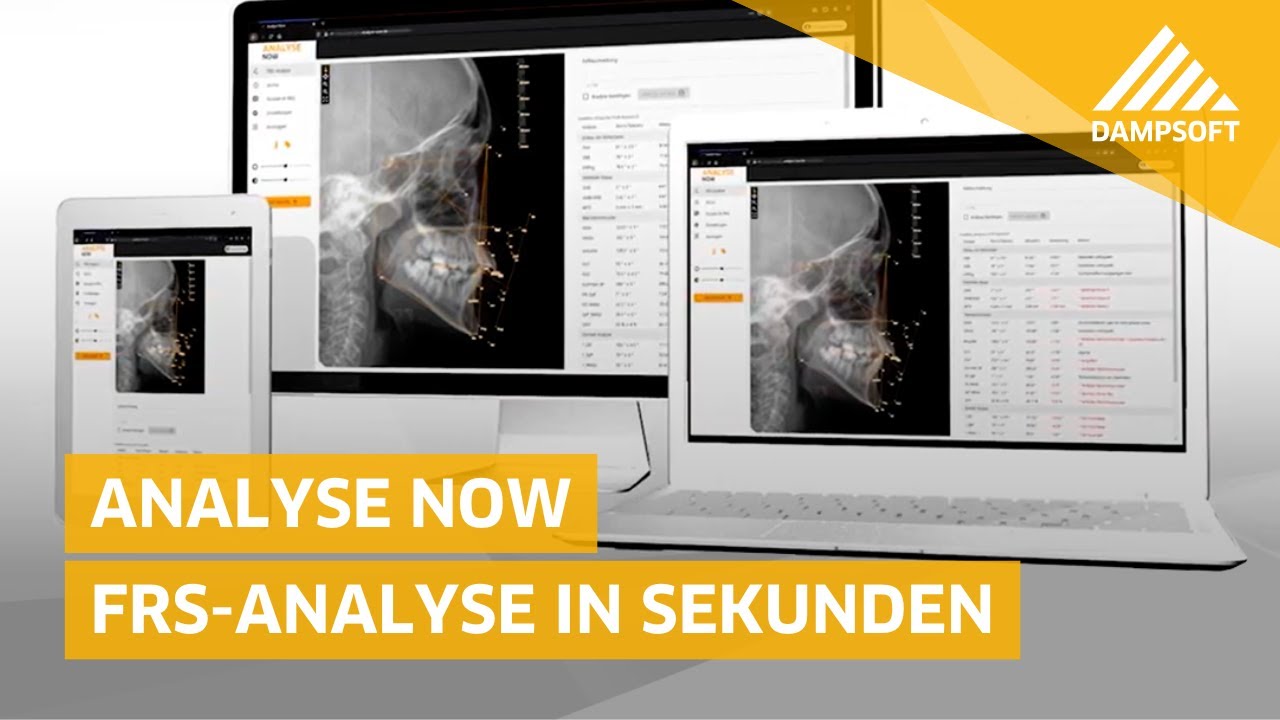 Analyse Now - FRS-Analyse in wenigen Sekunden - YouTube