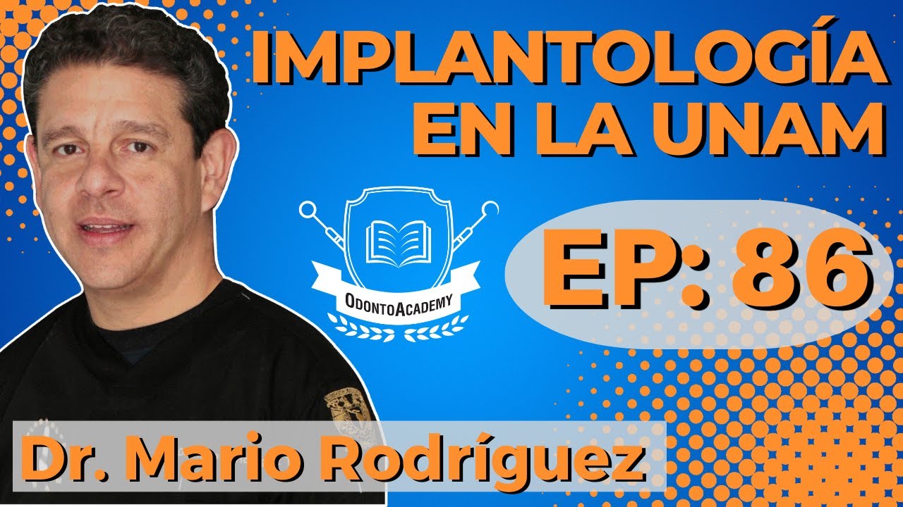 86 IMPLANTOLOGÍA EN LA UNAM I Dr. Mario Rodríguez - YouTube