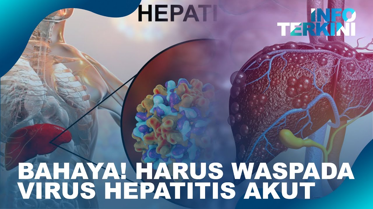 Virus Hepatitis Akut, Waspada Penyakit yang berbahaya!! - YouTube