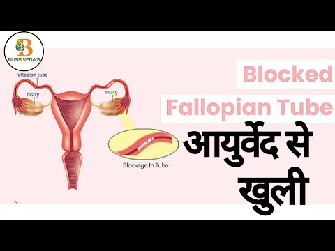 How I Unblocked My Fallopian Tubes Using Ayurveda - YouTube