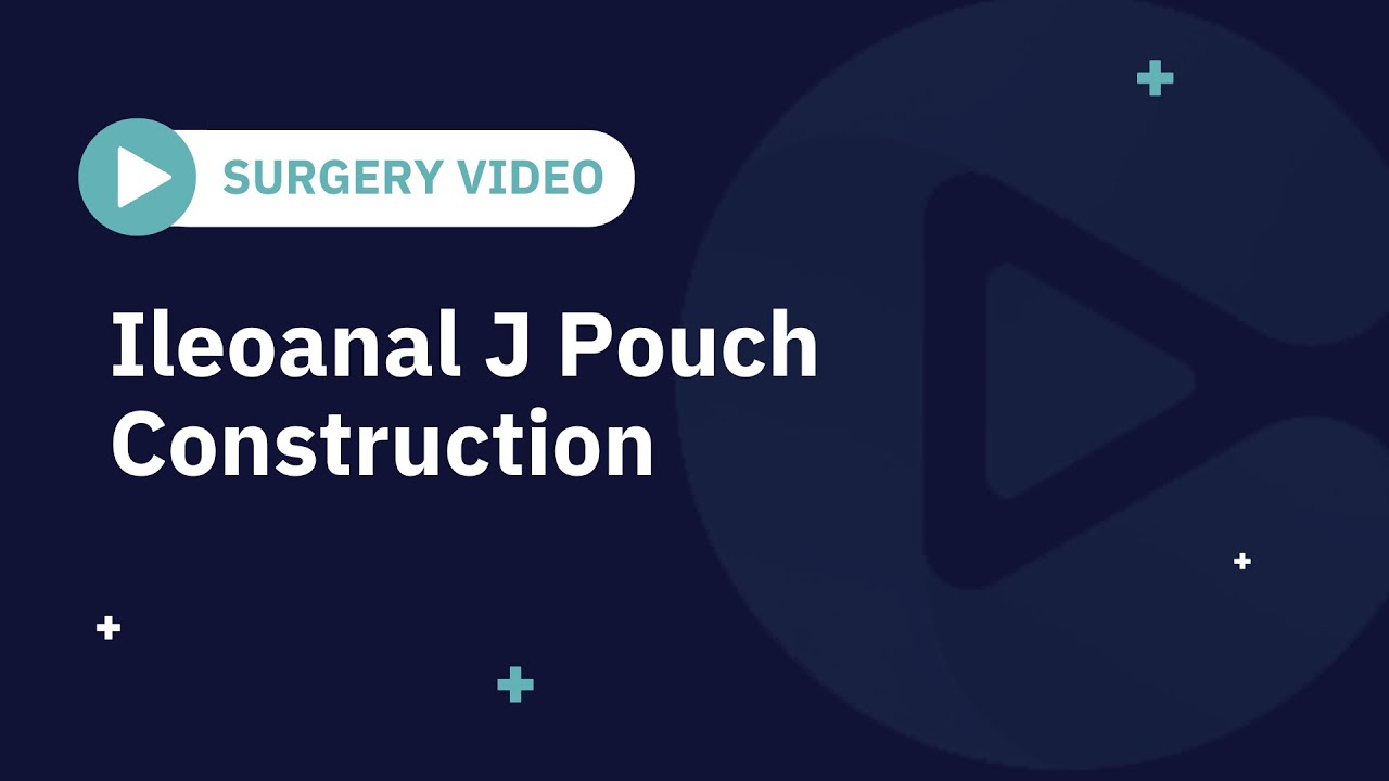 Surgery Video: Ileoanal J Pouch Construction 1 - YouTube