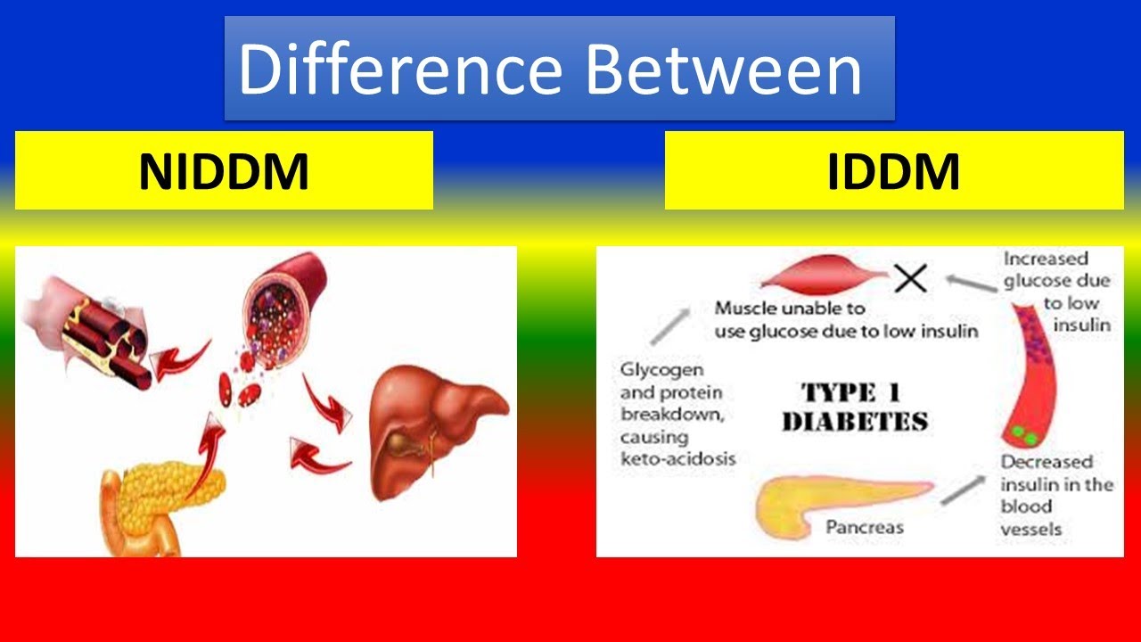 Difference Between NIDDM And IDDM YouTube difference-between-niddm-and-iddm-youtube