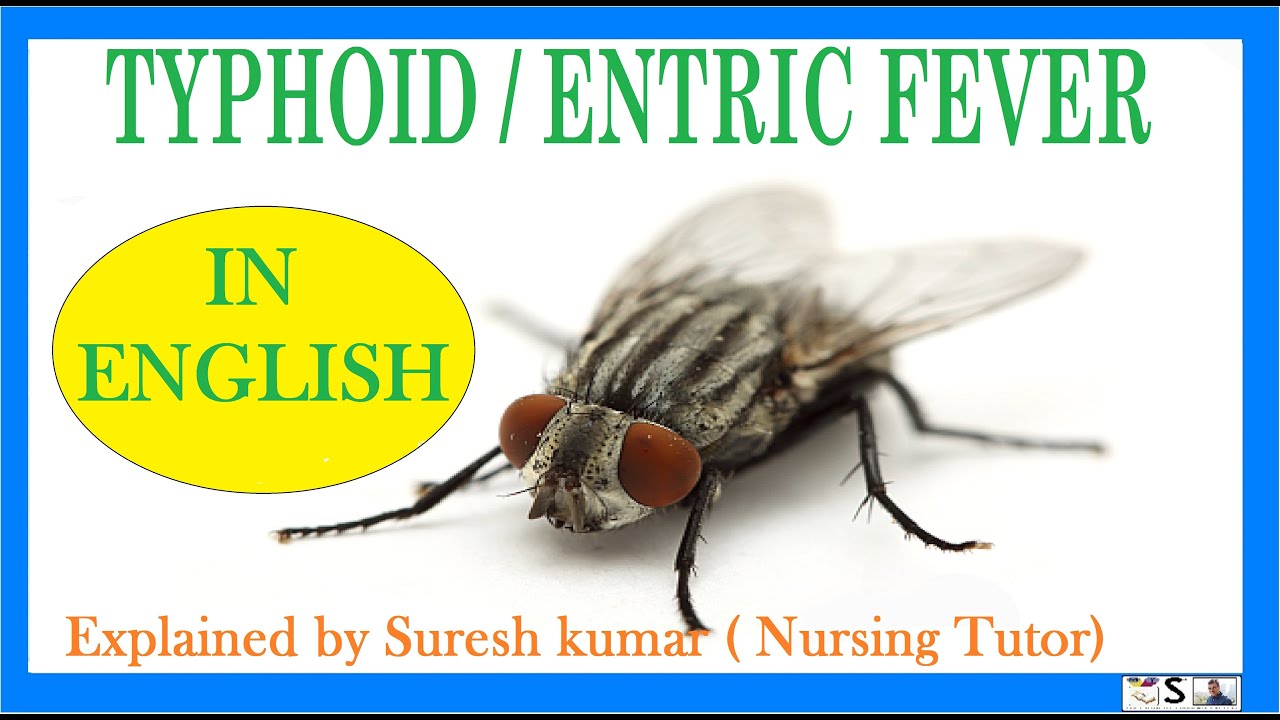 TYPHOID IN ENGLISH | ENTERIC FEVER | SALMONELLOSIS | SYMPTOMS OF ...
